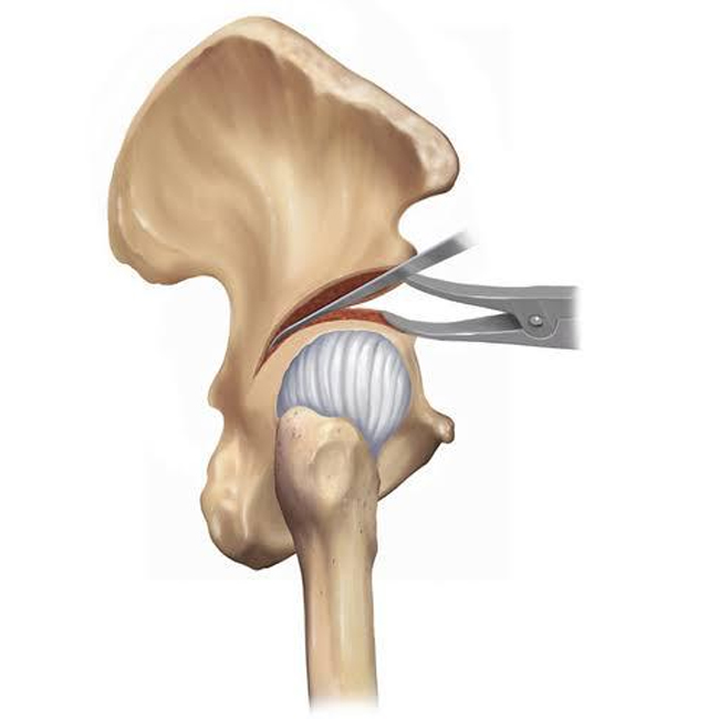 Bombay Orthopaedic Society - Official website of Bombay Orthopaedic Society